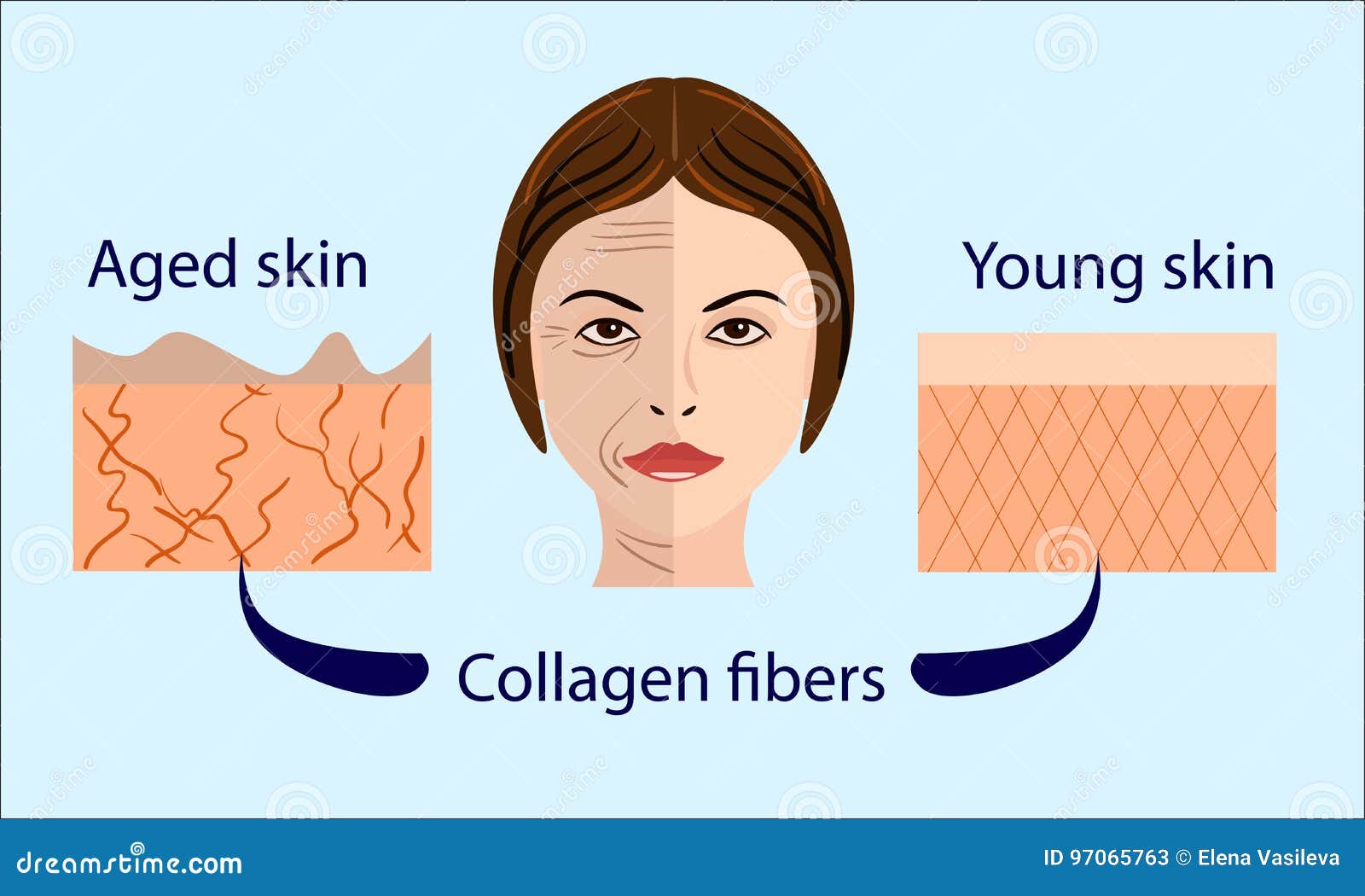 Skin Aging Diagrams. Young Skin is Firm Tight, Its Collagen Vector ... Skin Aging Diagrams. Young Skin is Firm Tight, Its Collagen Vector ...