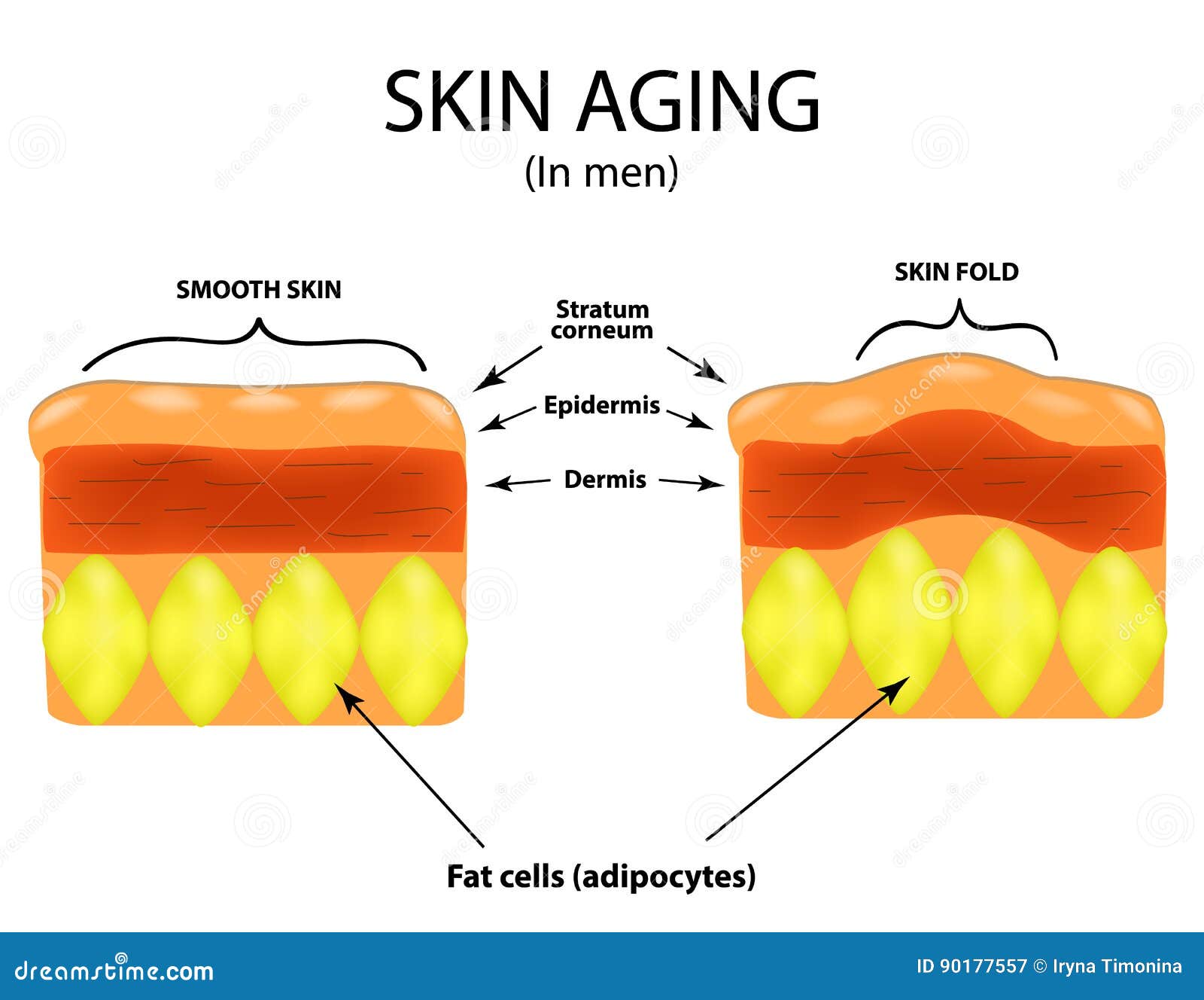 Skin Aging in Men. Infographics Stock Vector - Illustration of human ...
