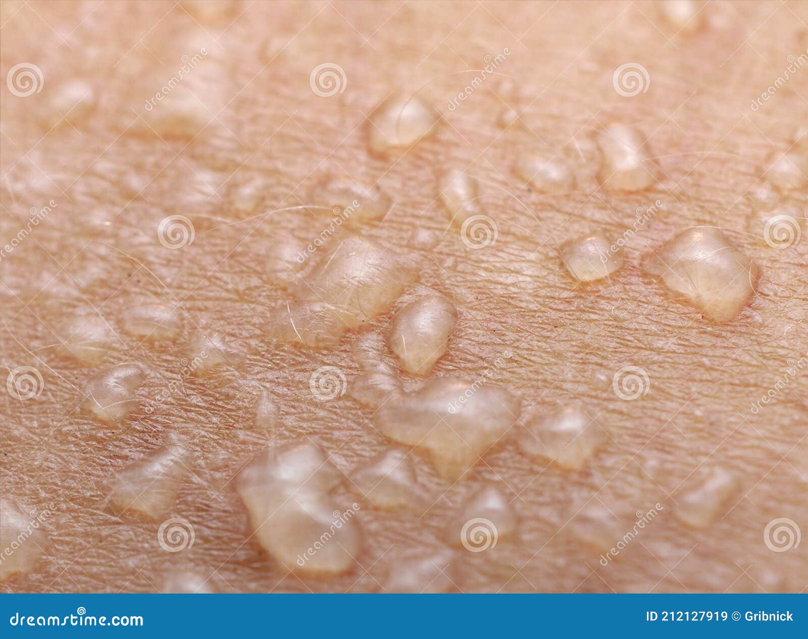 Scratching The Blisters Scab On Leg Royalty-Free Stock Image ...