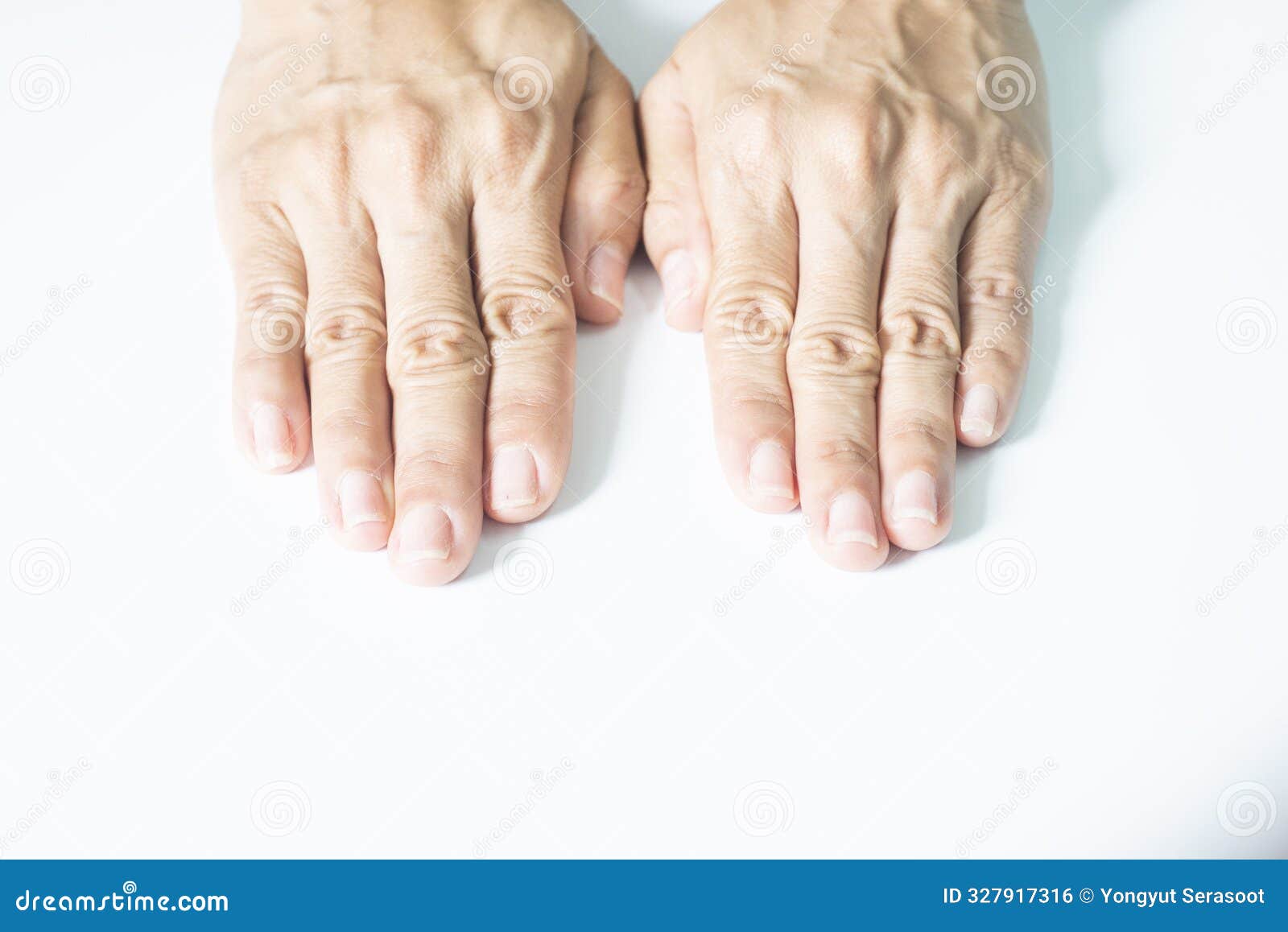 Skin of Both Hands and Finger Gesture Stock Photo - Image of morbid ...