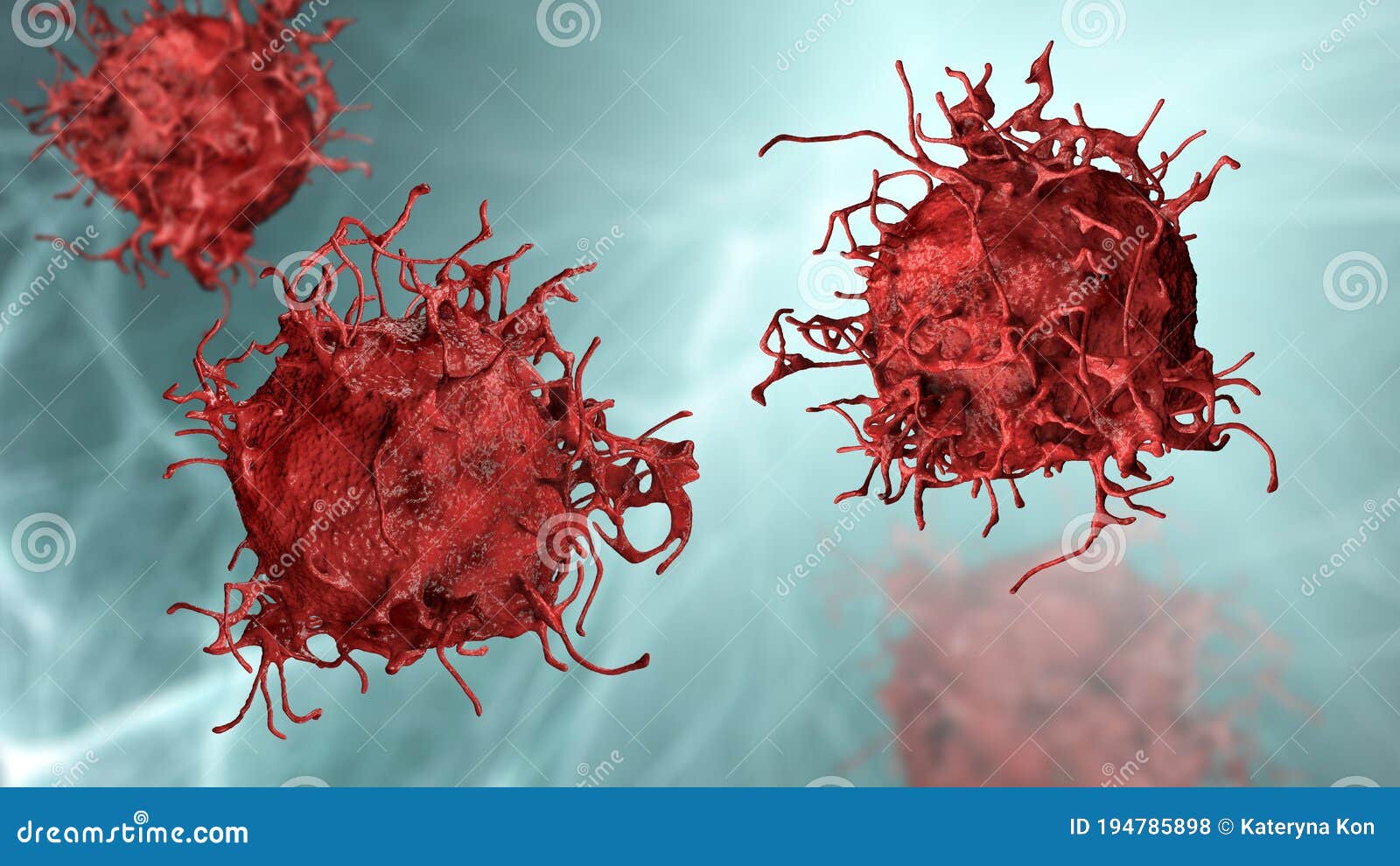 Skin cancer cells stock illustration. Illustration of treatment - 194785898