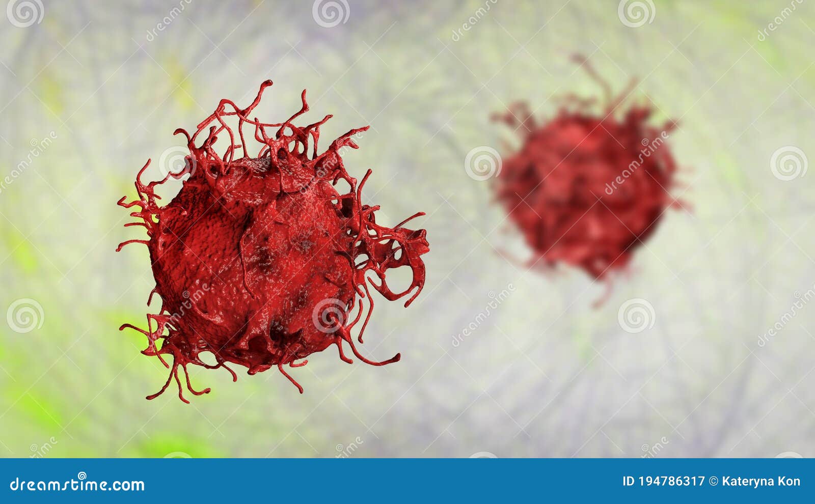Skin cancer cells stock illustration. Illustration of treatment - 194786317