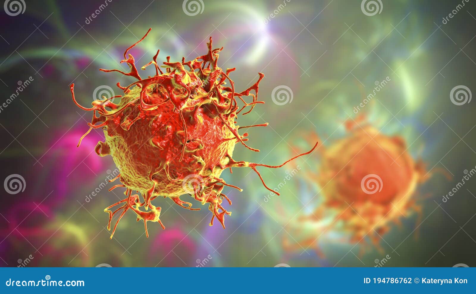 Skin cancer cells stock illustration. Illustration of carcinoma - 194786762