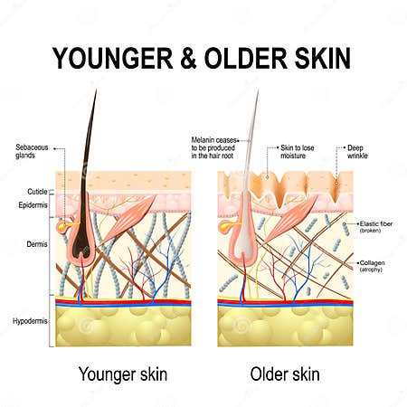 Skin Changes or Ageing Skin. Stock Vector - Illustration of fibre ...