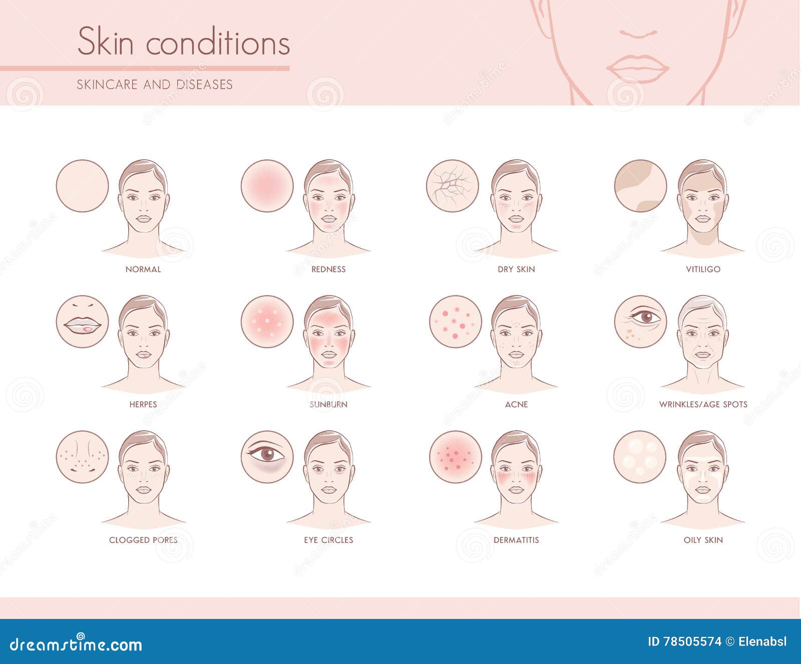 Skin conditions stock vector. Illustration of facial - 78505574