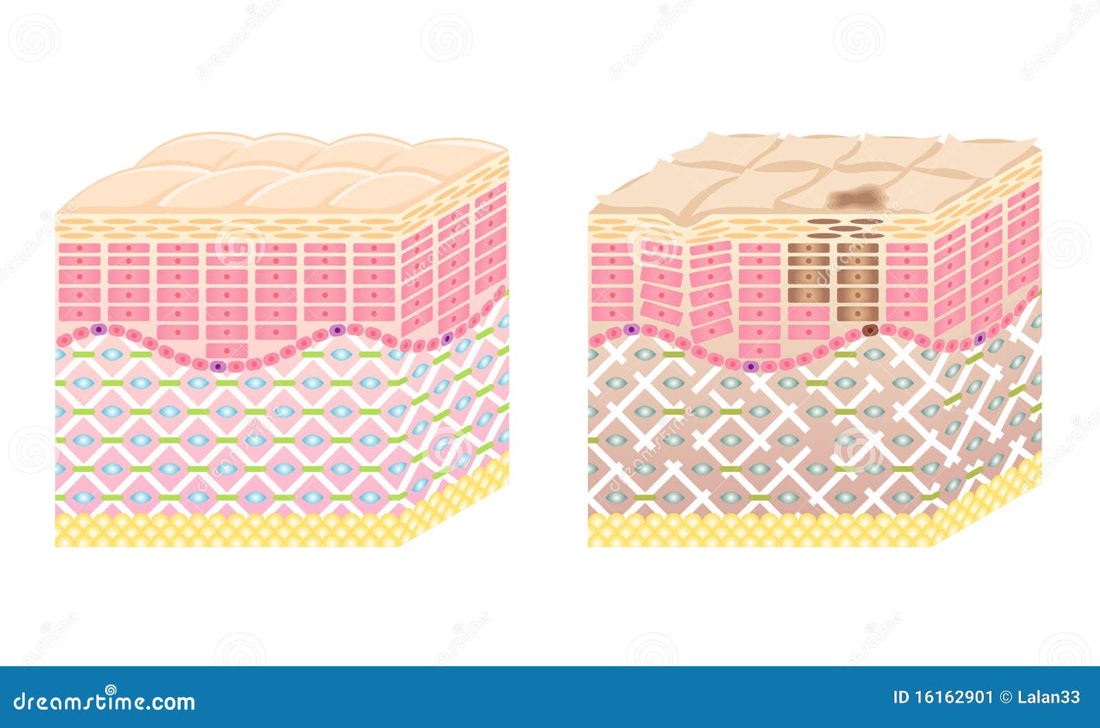 Skin cross-section stock vector. Illustration of diagram - 16162901