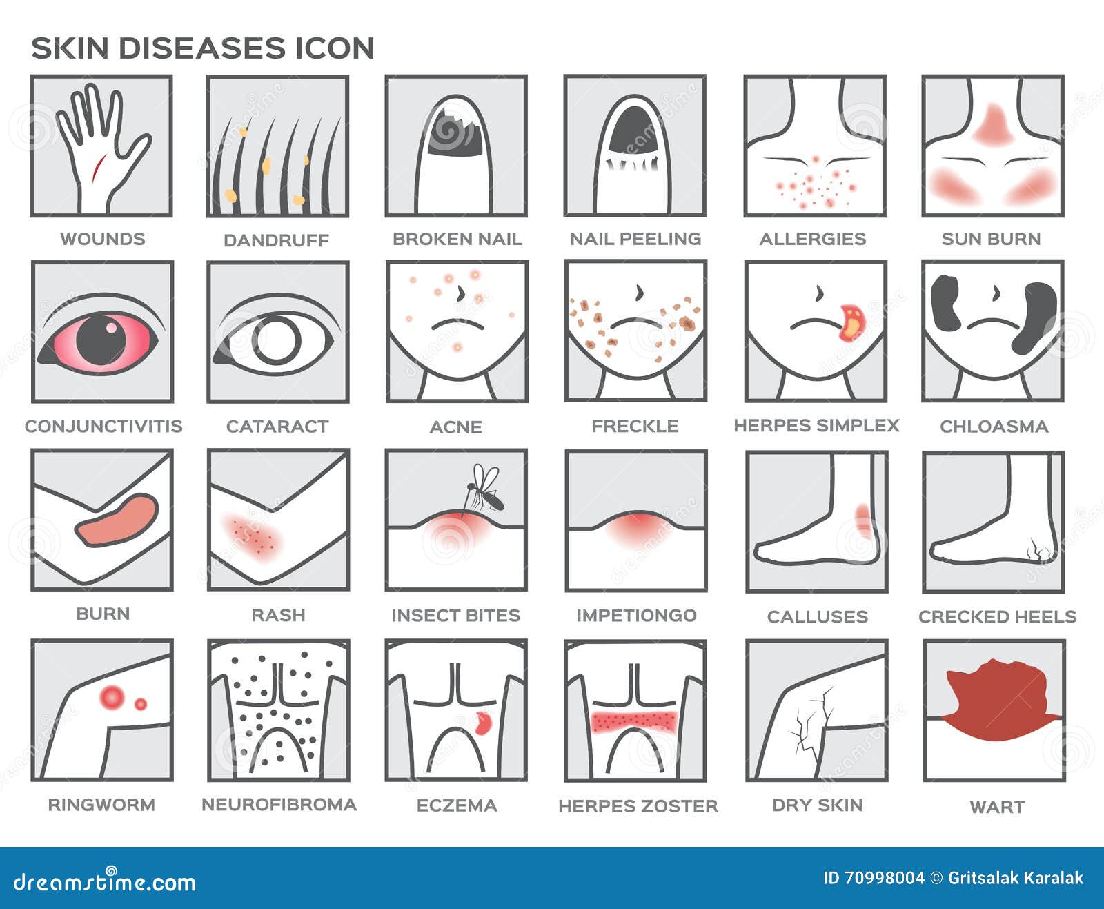 Face Redness Icon Stock Illustrations – 194 Face Redness Icon Stock ...