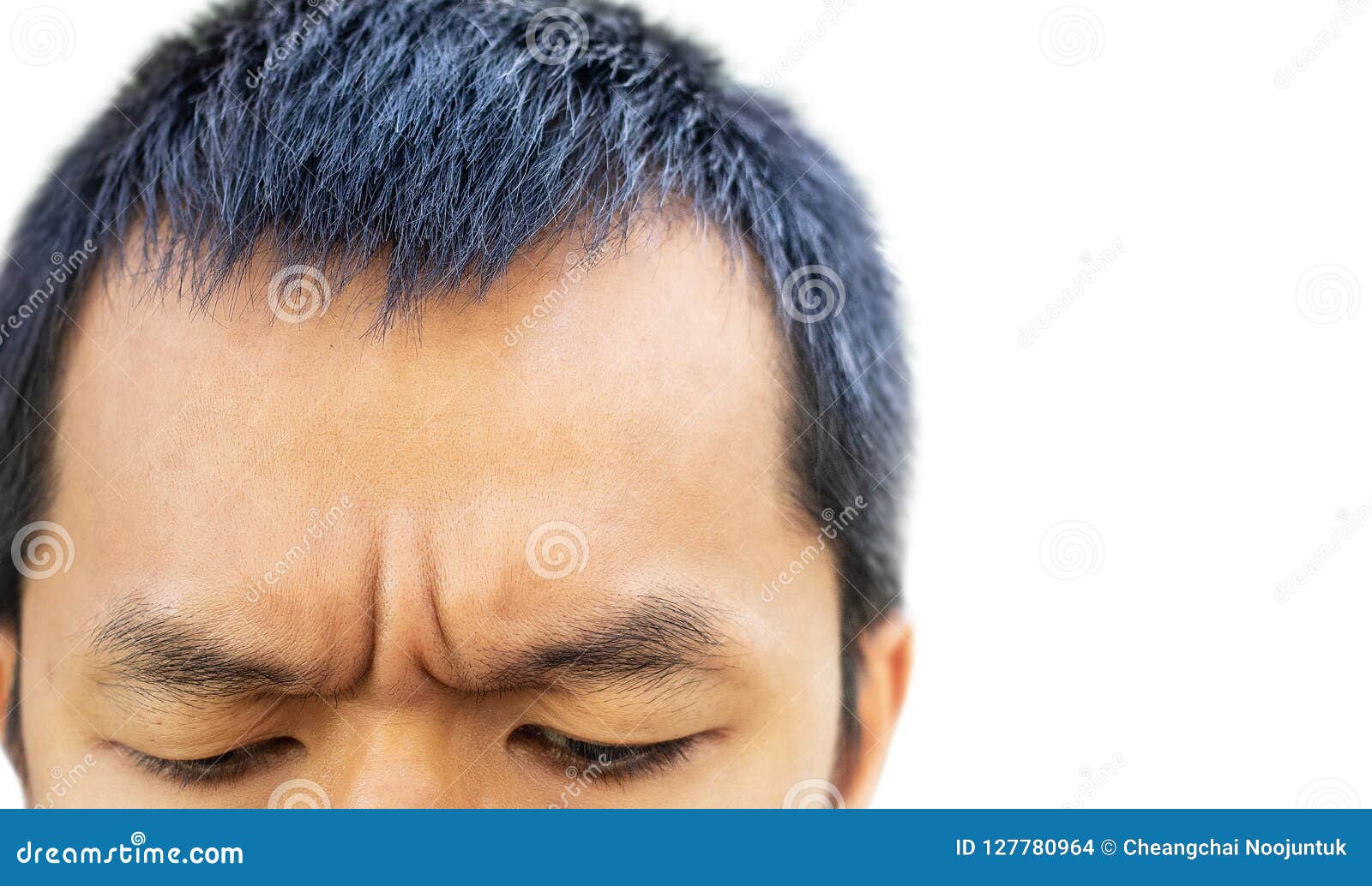 Skin on the Forehead of a Man Stock Photo - Image of face, visage ...