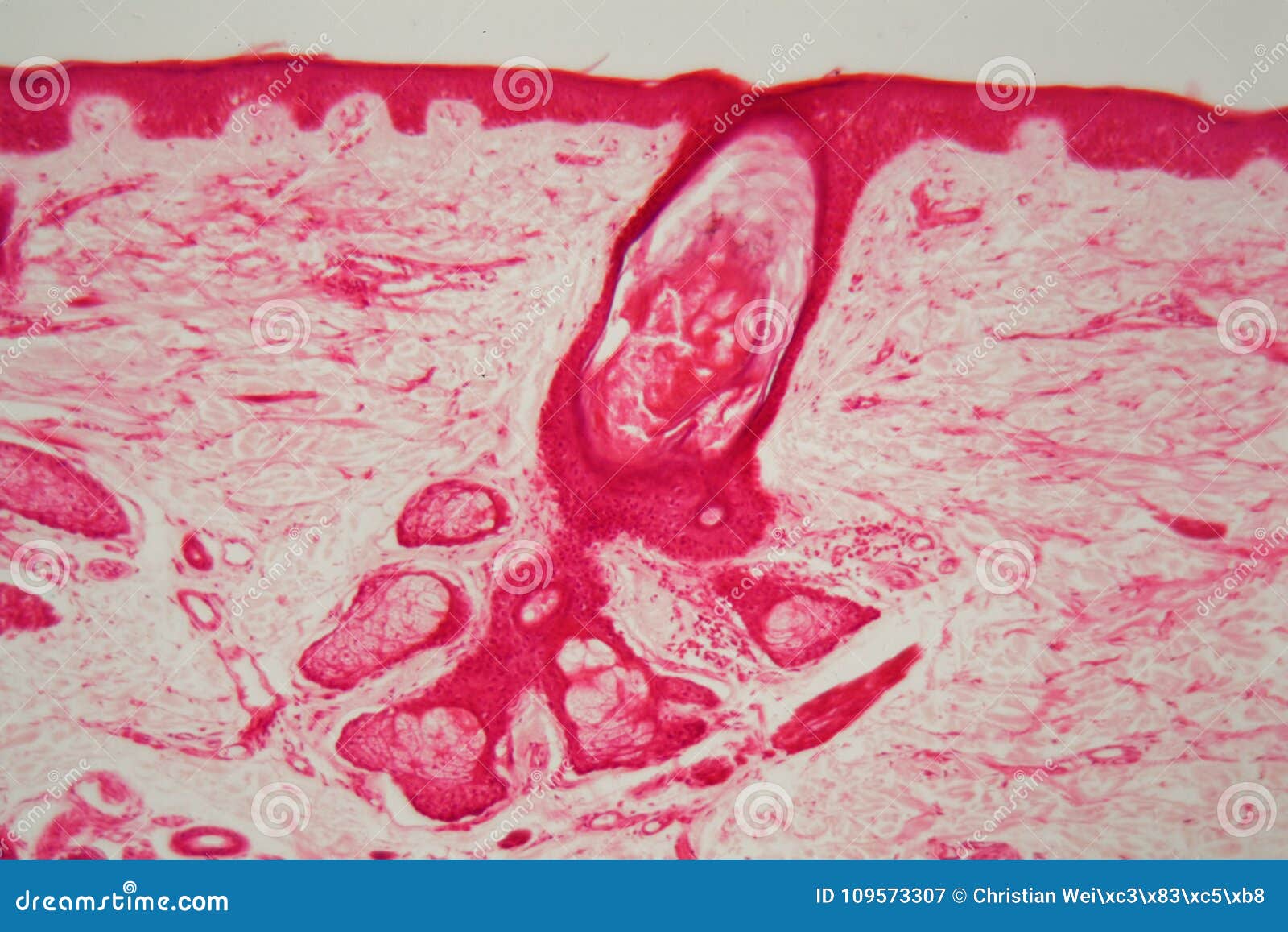 Skin with Follicle Under the Microscope Stock Image - Image of ...