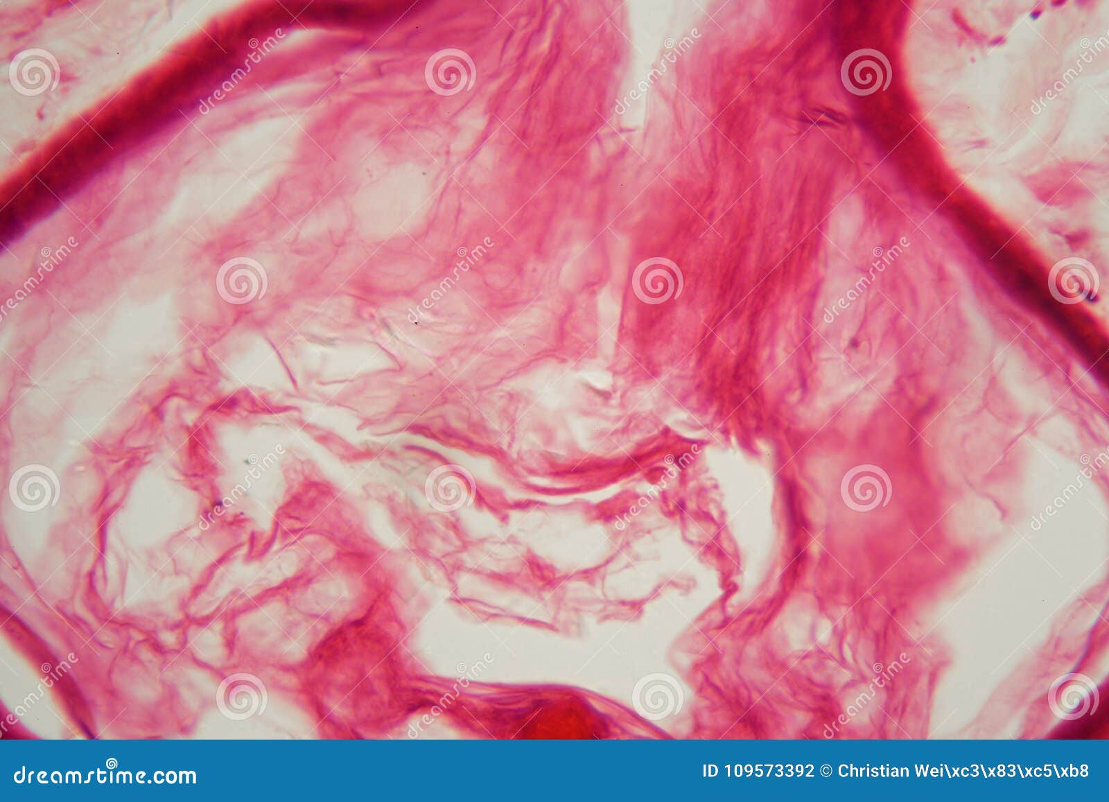 Skin with Follicle Under the Microscope Stock Photo - Image of ...
