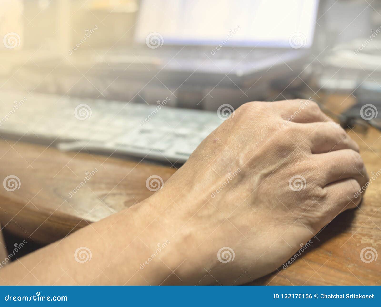The Skin of the Hand through Hard Work Stock Photo - Image of male ...