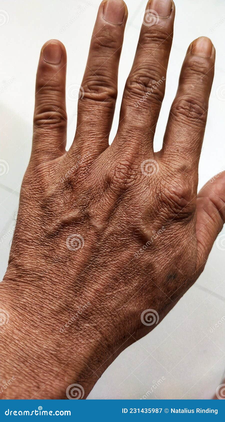 The Skin on the Hands is Wrinkled and Dull Brown Stock Image - Image of ...