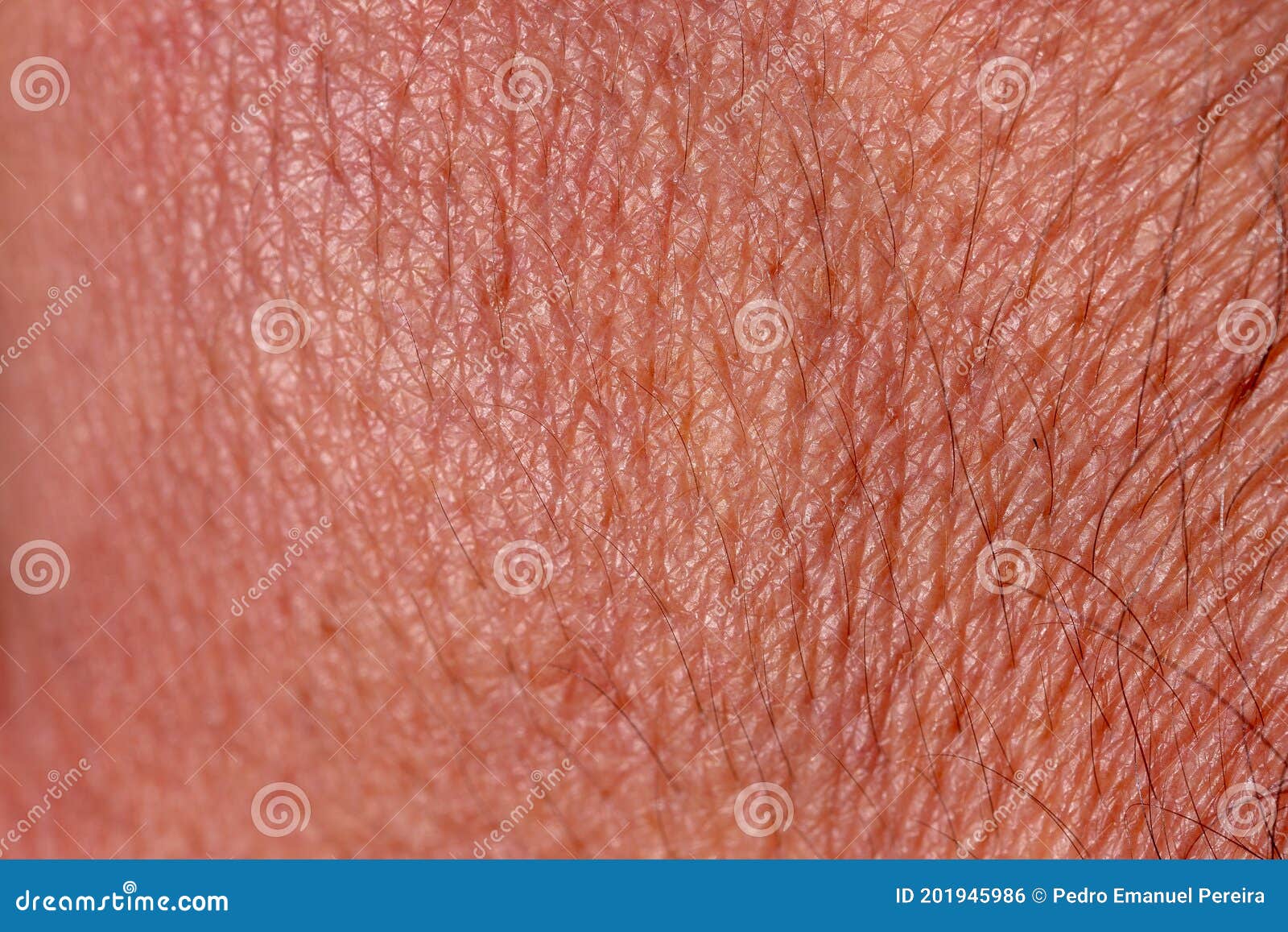 Skin of a Human Hand Where Hair Can Be Seen. Stock Photo - Image of ...