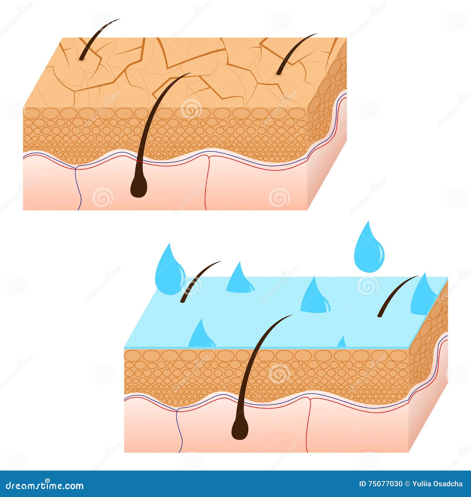 Skin Hydration and Dry Skin Sectional View. Stock Vector - Illustration ...