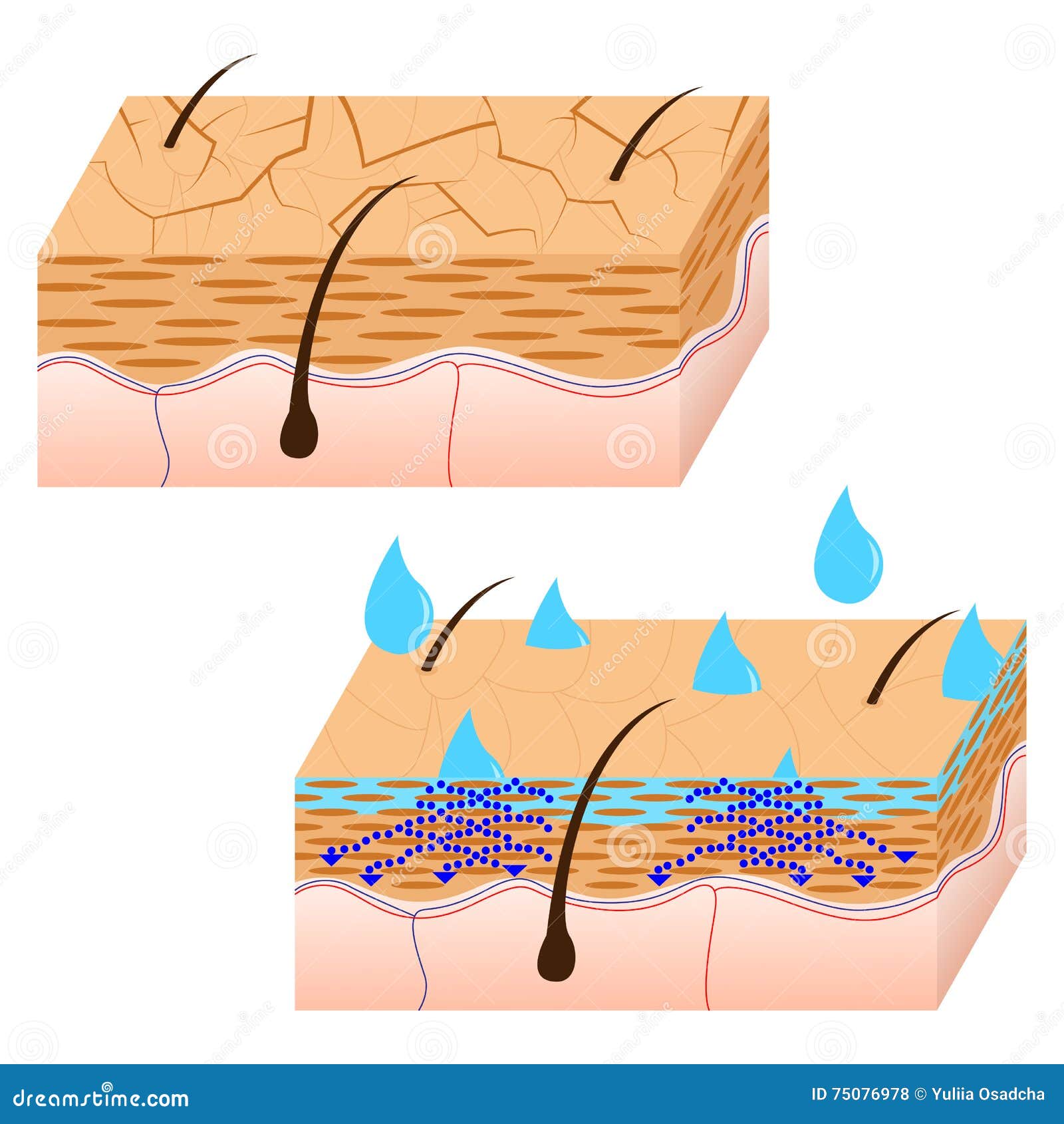 Skin Hydration Sectional View. Vector Illustration | CartoonDealer.com ...