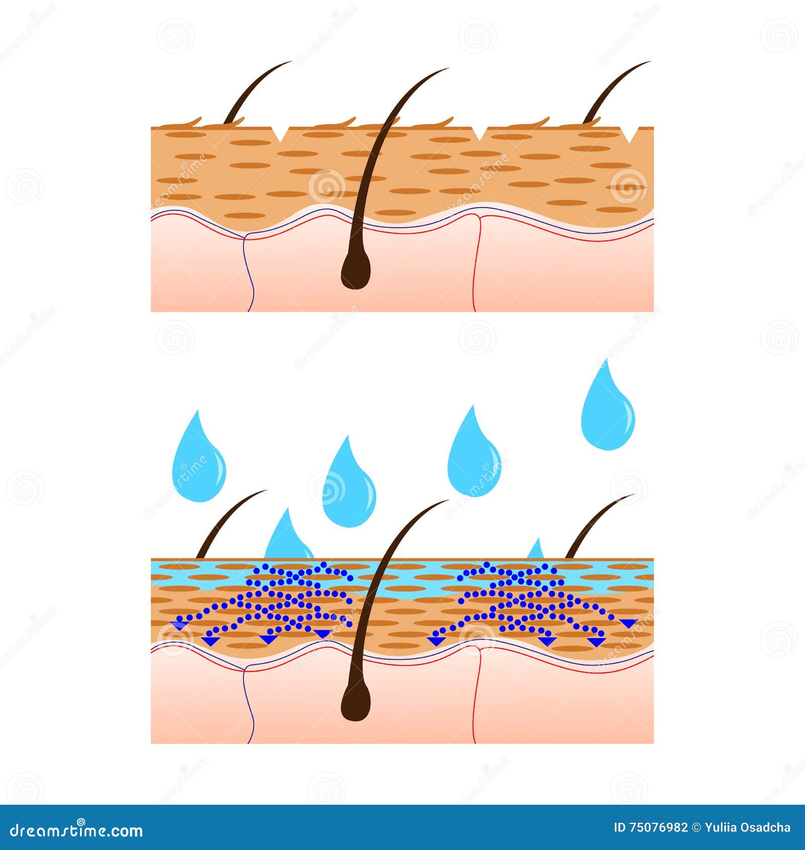 Skin Hydration Sectional View. Stock Vector - Illustration of beauty ...
