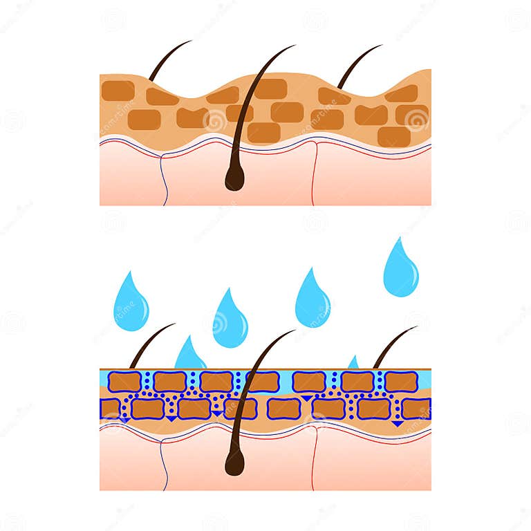 Skin Hydration Sectional View. Stock Vector - Illustration of hydration ...