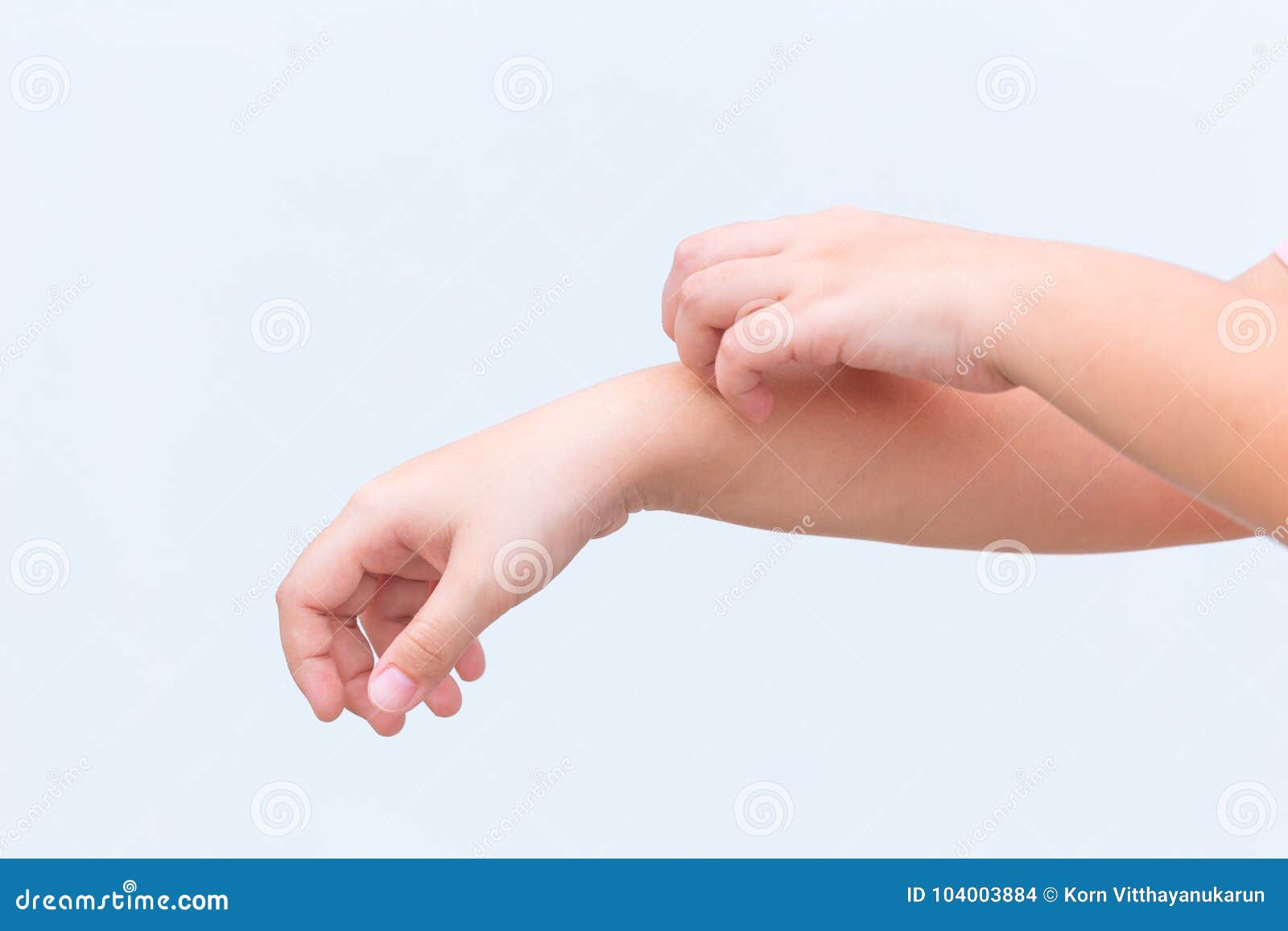 Hand Scratching ,legs Of Little Girl With Swelling Spot , Royalty-Free ...