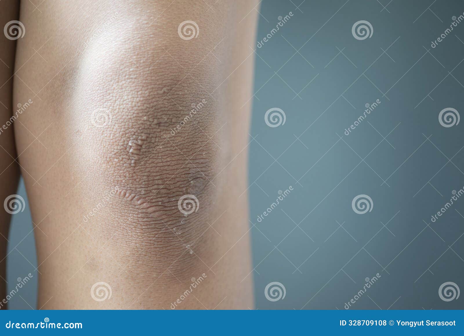 The Skin of the Knees is Wrinkled and Rough Stock Photo - Image of skin ...