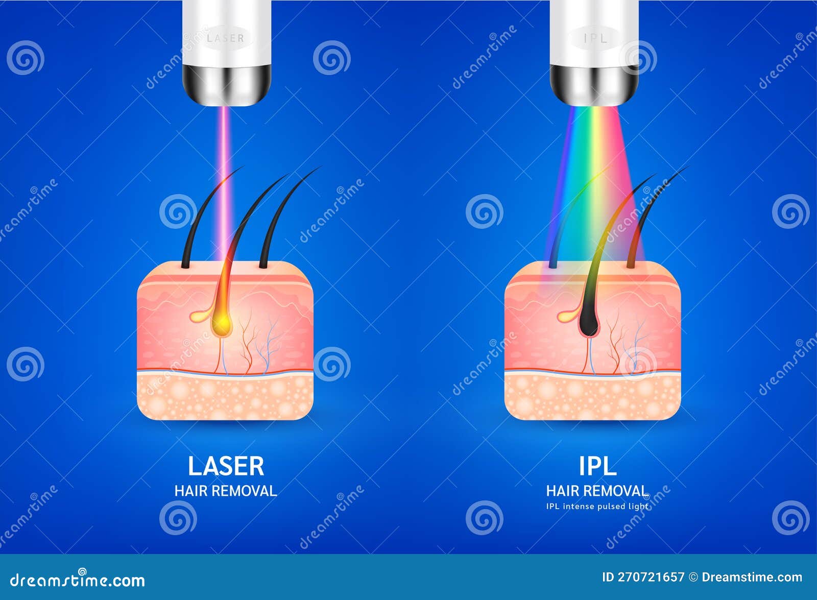 Skin Layers Anatomy With Hairs Laser And Ipl Light Intense Pulsed