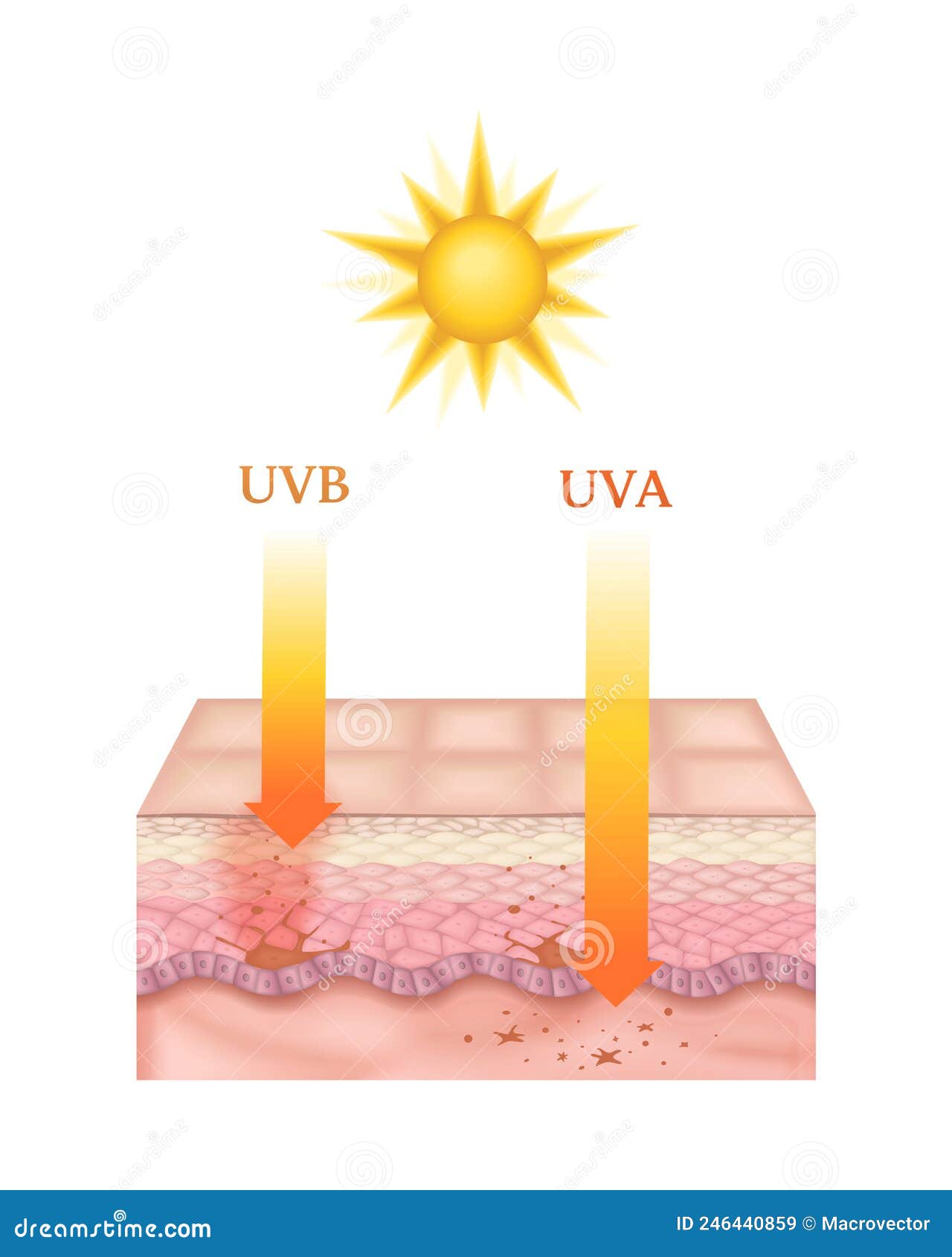 UV Penetration Into The Layers Of The Skin. Infographic Of Sunscreen ...