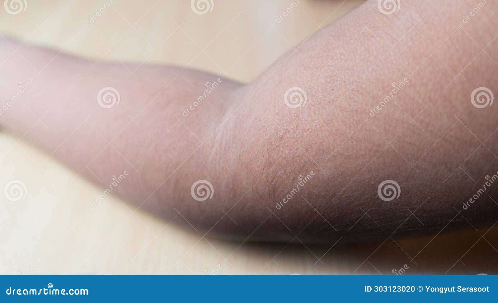 Skin and Pores of the Human Arm Stock Photo - Image of textured ...