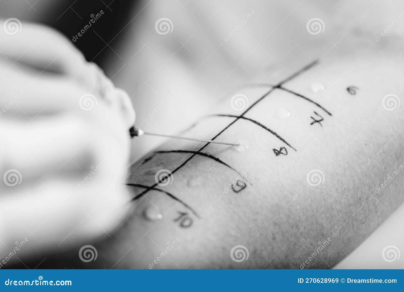 Skin Allergy Testing stock image. Image of hand, pipette - 270628969