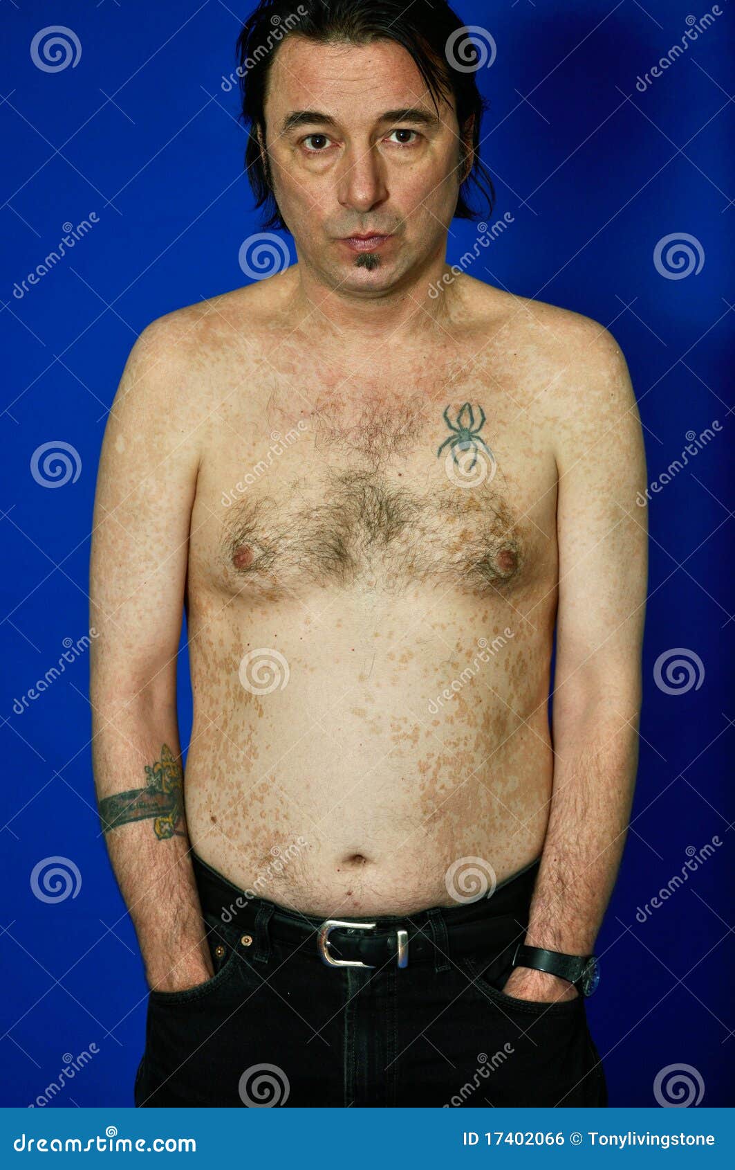 Skin problem stock photo. Image of rush, reaction, skin - 17402066