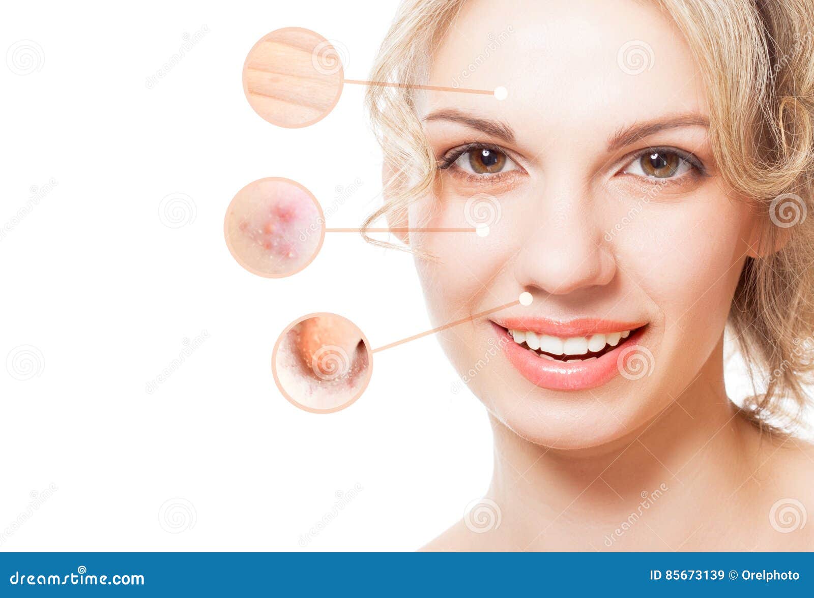 Skin problem of woman face stock image. Image of isolated - 85673139