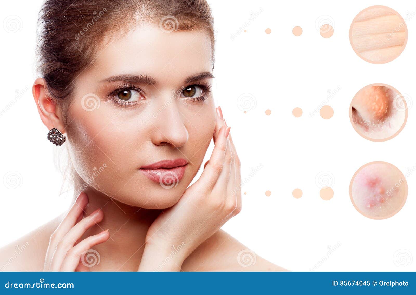 Skin problem of woman face stock image. Image of makeup - 85674045