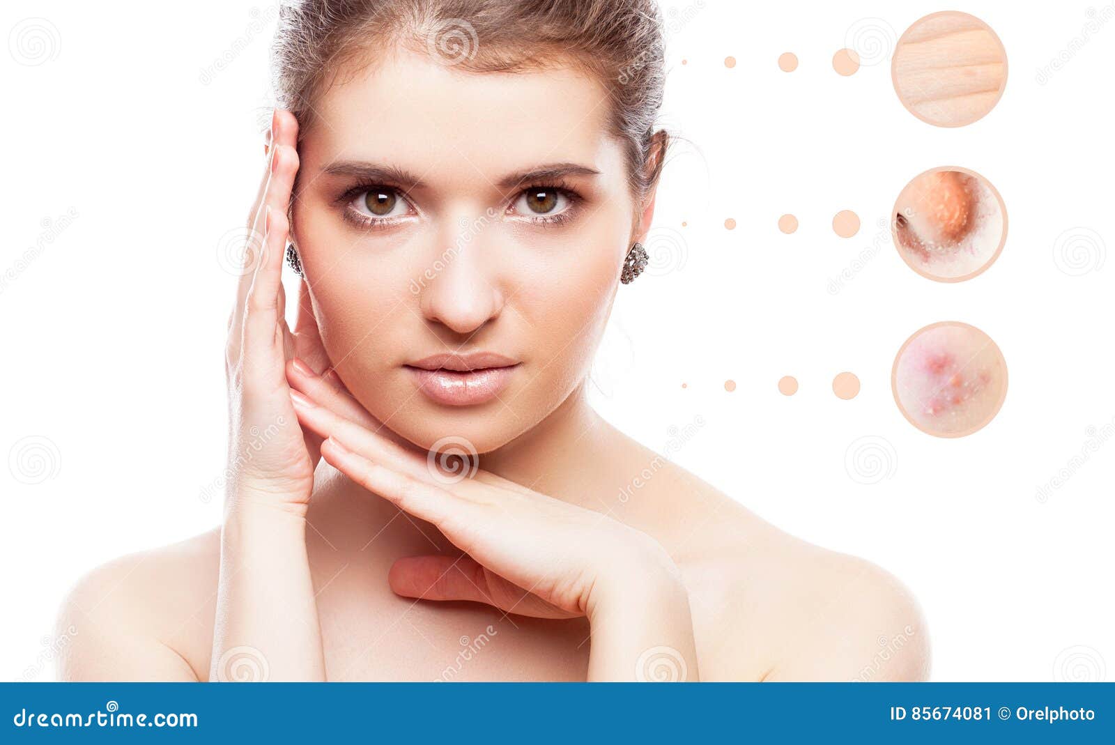 Skin problem of woman face stock image. Image of complexion - 85674081