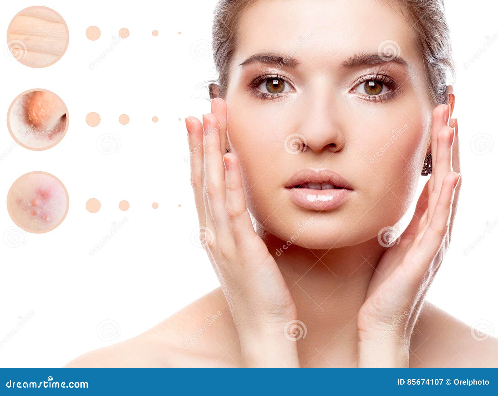 Skin problem of woman face stock image. Image of facial - 85674107