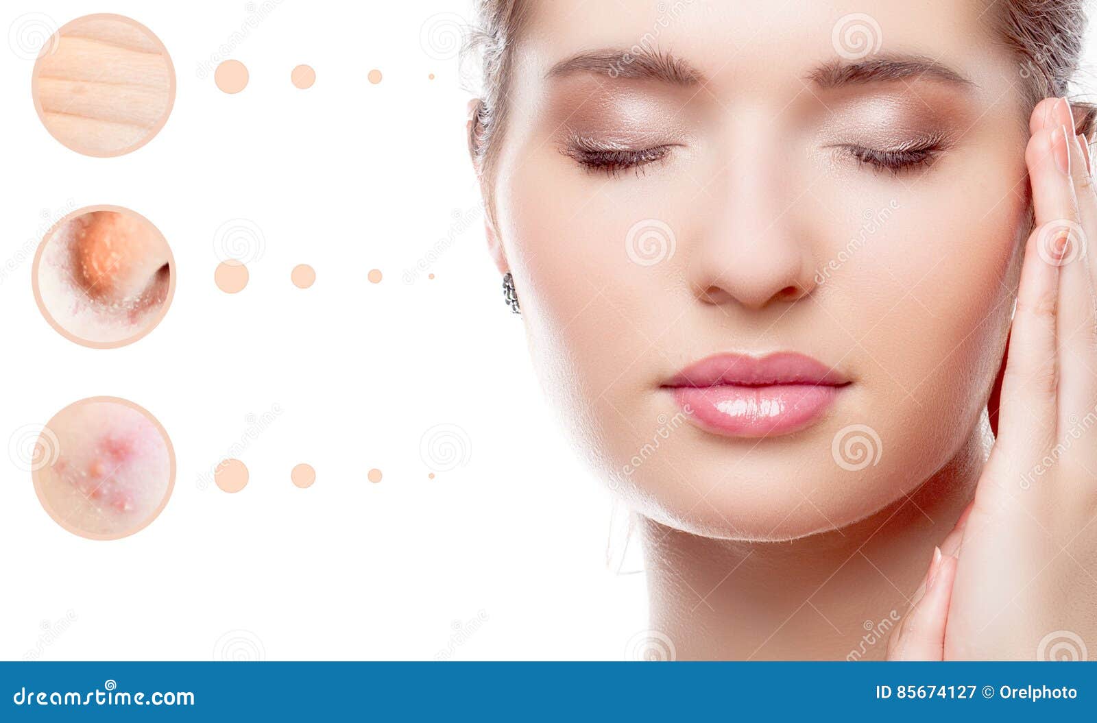 Skin problem of woman face stock image. Image of cosmetic - 85674127