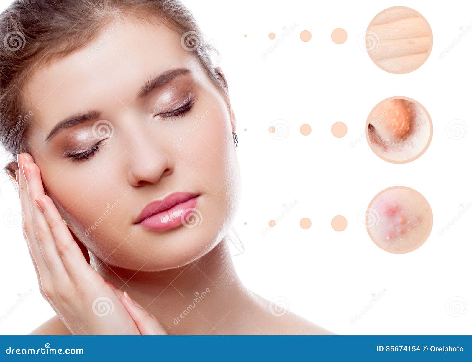 Skin problem of woman face stock photo. Image of complexion - 85674154