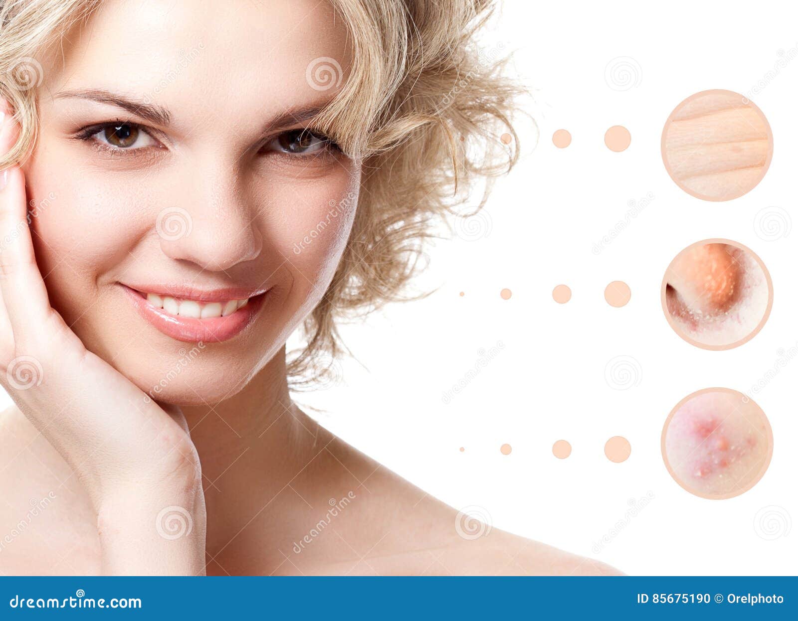 Skin problem of woman face stock photo. Image of natural - 85675190