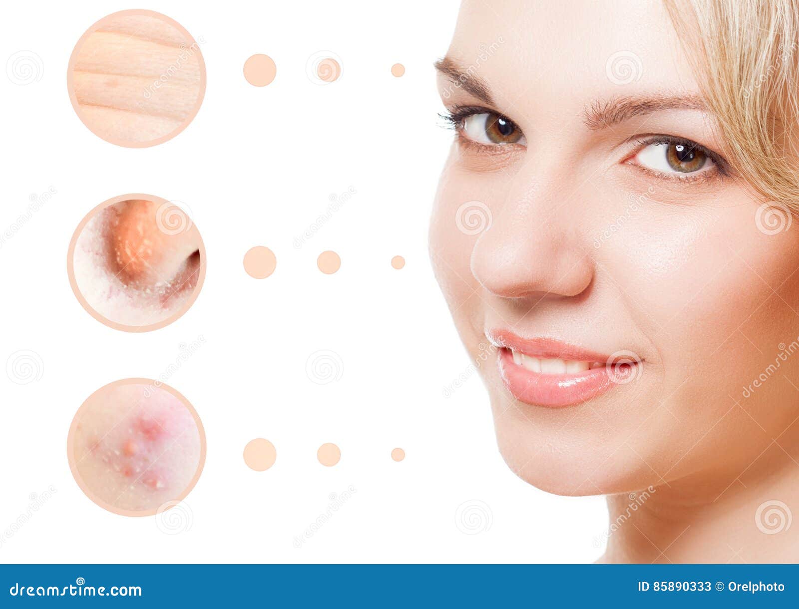 Skin problem of woman face stock image. Image of closeup - 85890333