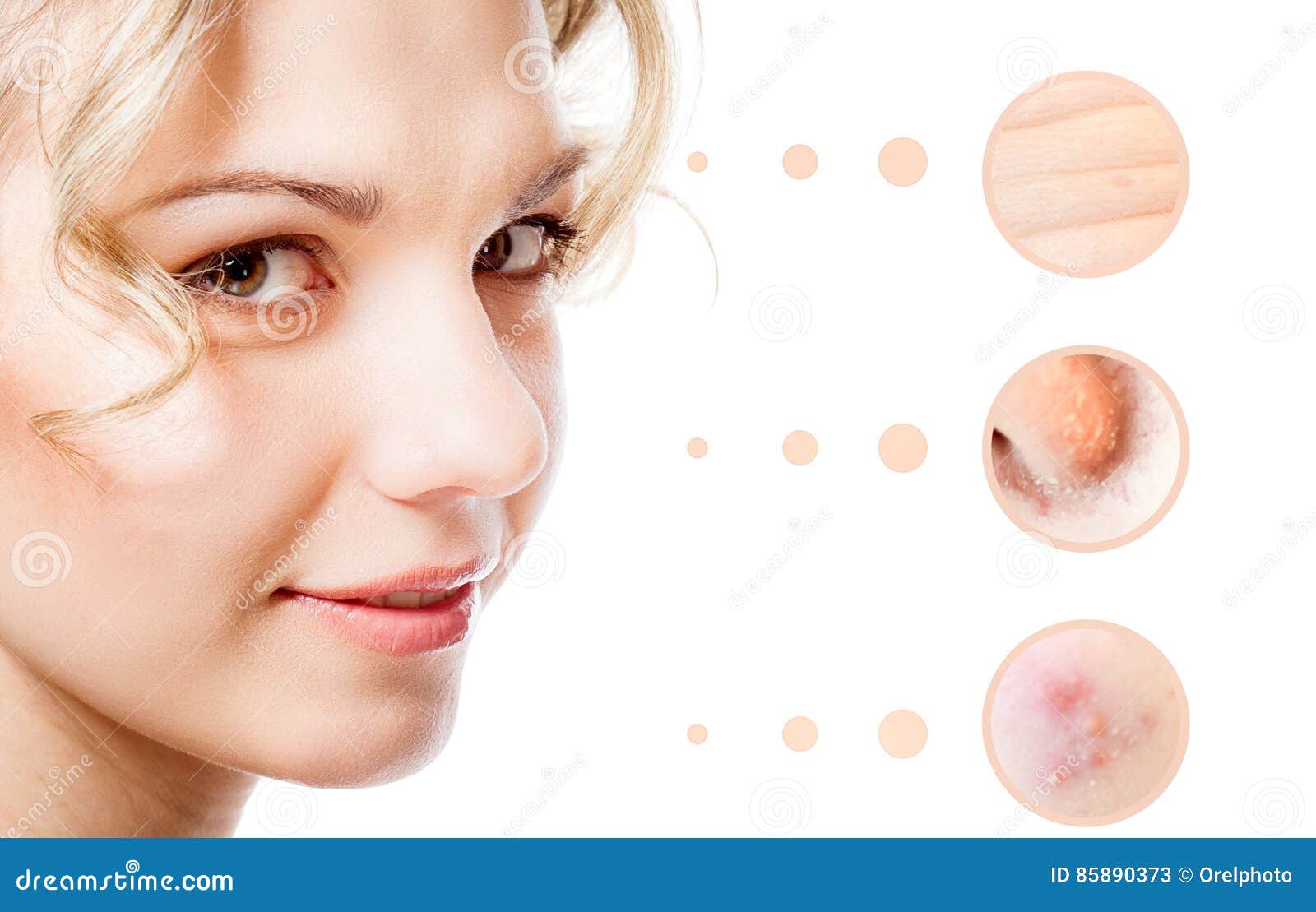 Skin problem of woman face stock image. Image of face - 85890373