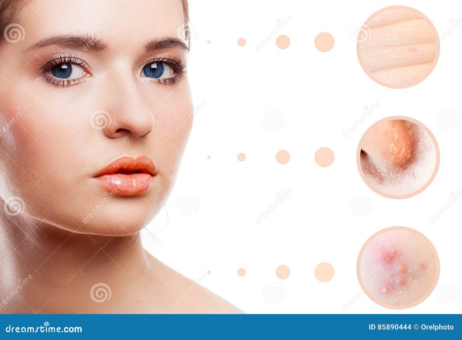 Skin problem of woman face stock photo. Image of fashion - 85890444