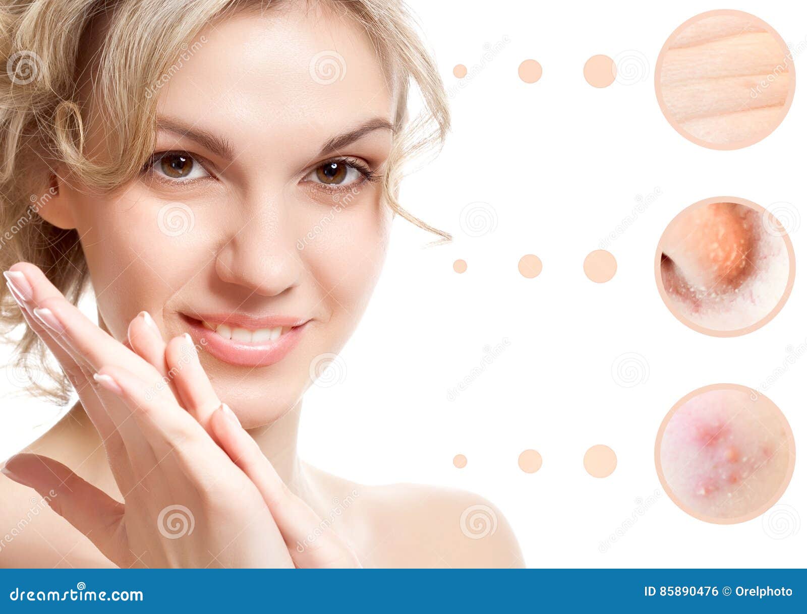 Skin problem of woman face stock photo. Image of cosmetology - 85890476