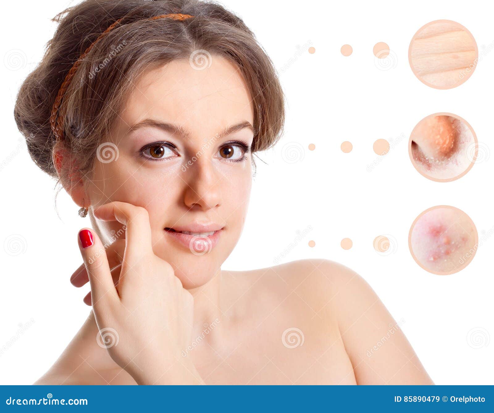Skin problem of woman face stock image. Image of female - 85890479