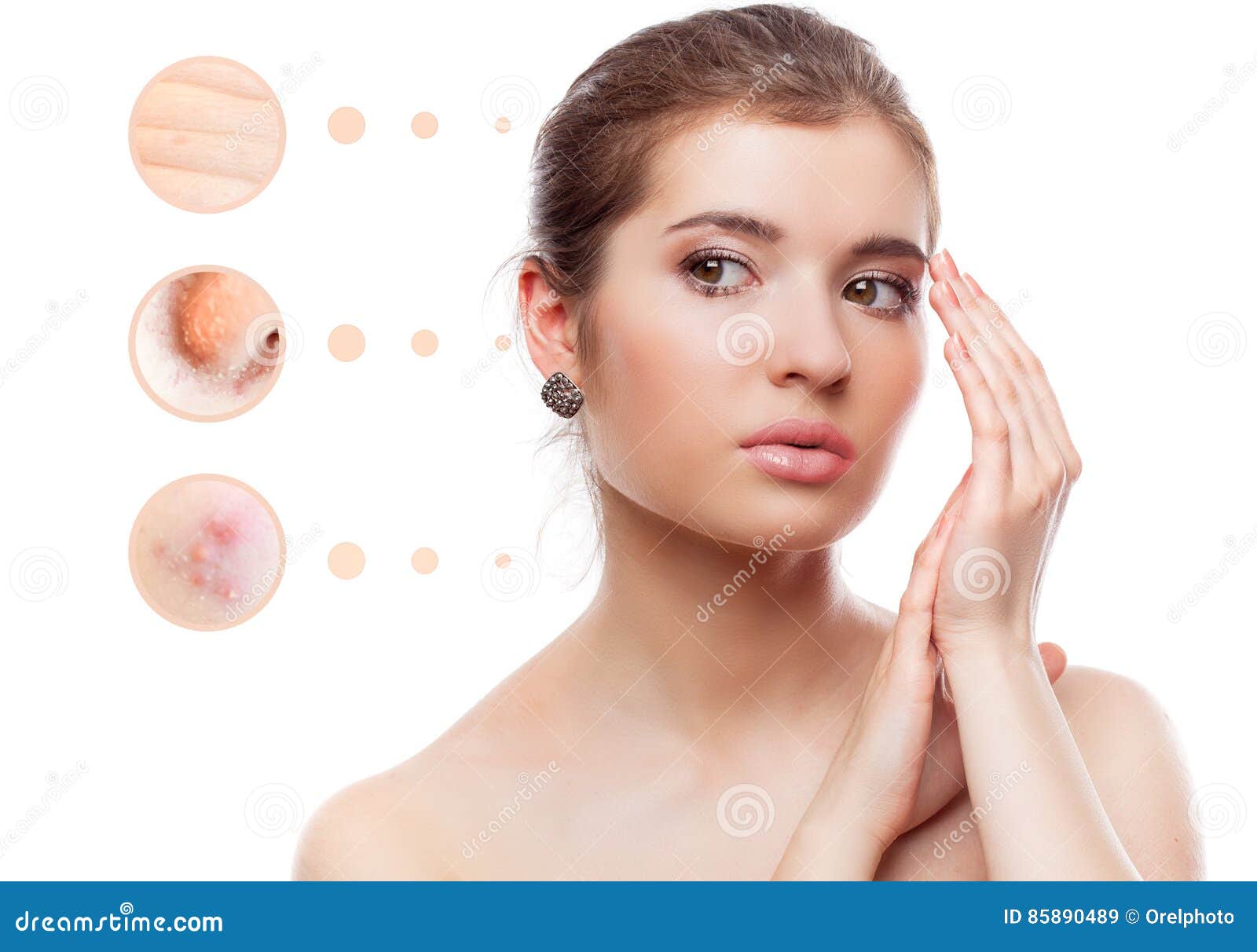 Skin problem of woman face stock image. Image of concept - 85890489