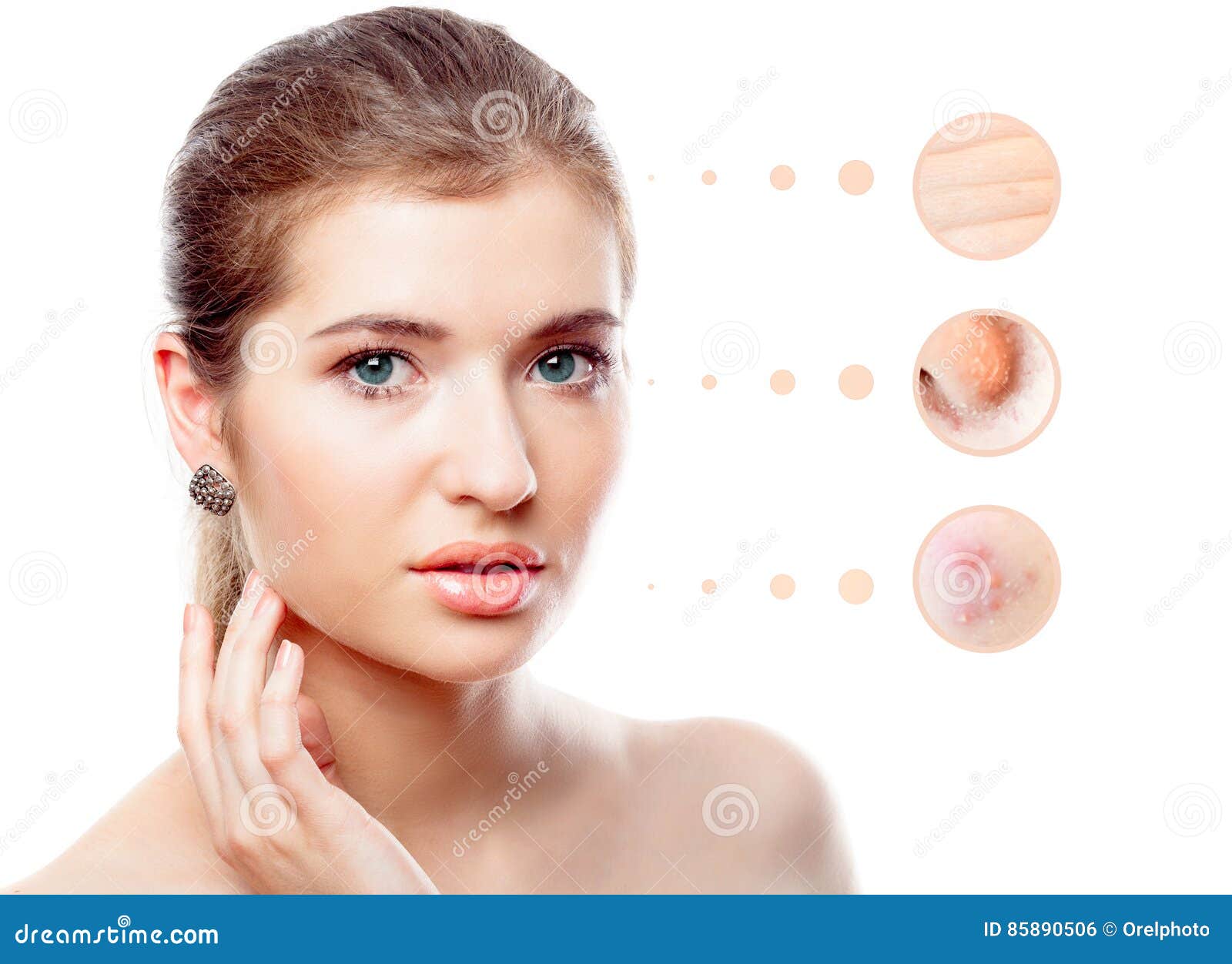 Skin problem of woman face stock photo. Image of human - 85890506