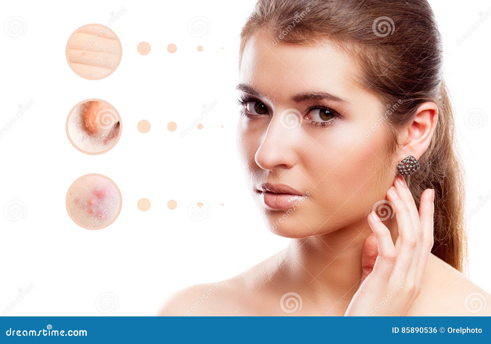 Skin problem of woman face stock photo. Image of complexion - 85890536