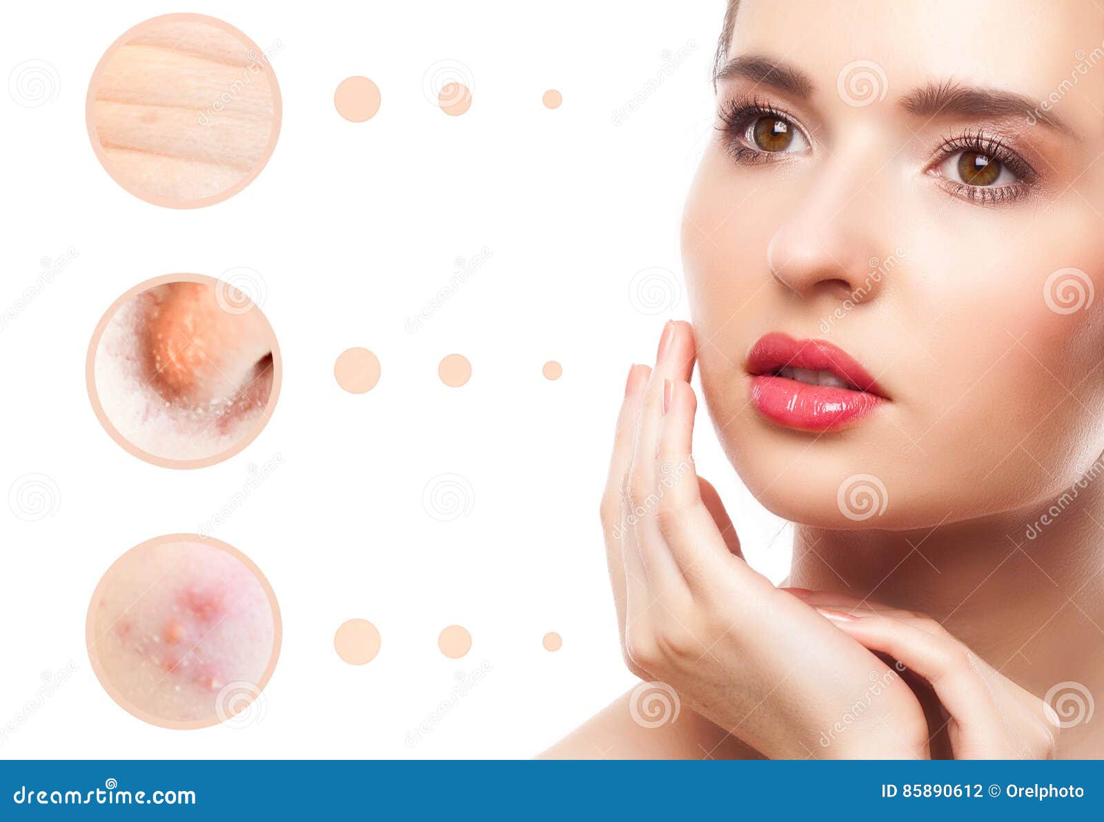 Skin problem of woman face stock photo. Image of face - 85890612