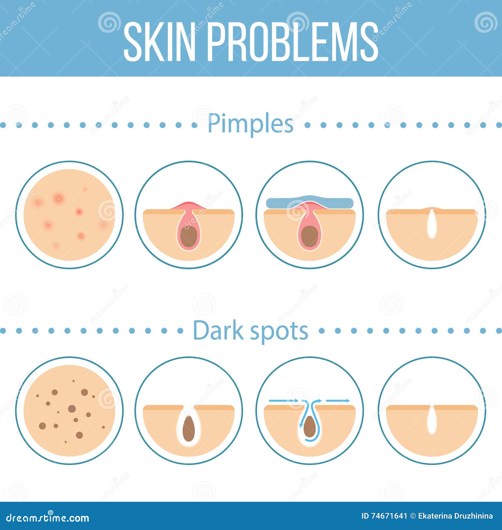 Skin problems icons stock vector. Illustration of cosmetic - 74671641