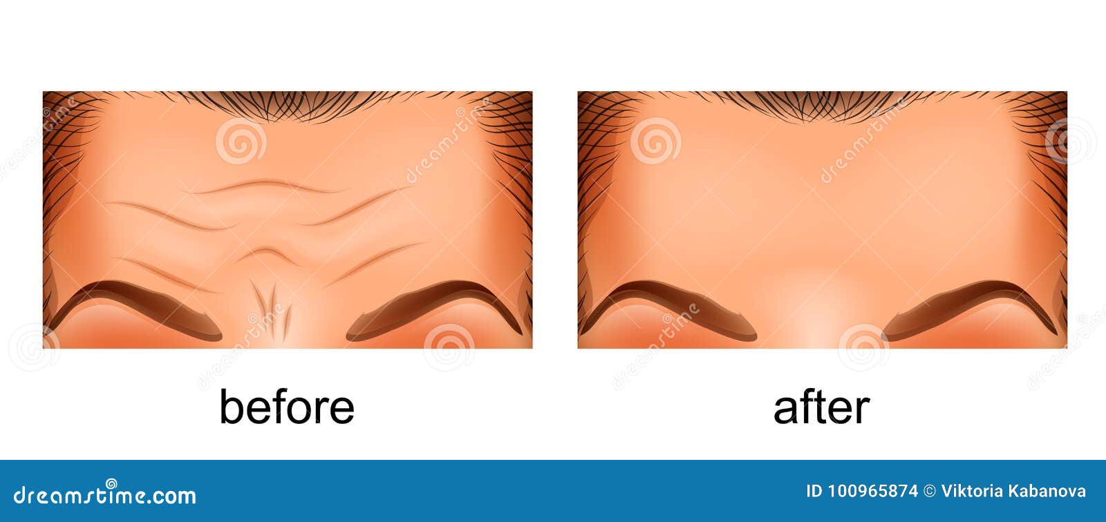 Forehead Cartoons, Illustrations & Vector Stock Images - 9463 Pictures ...