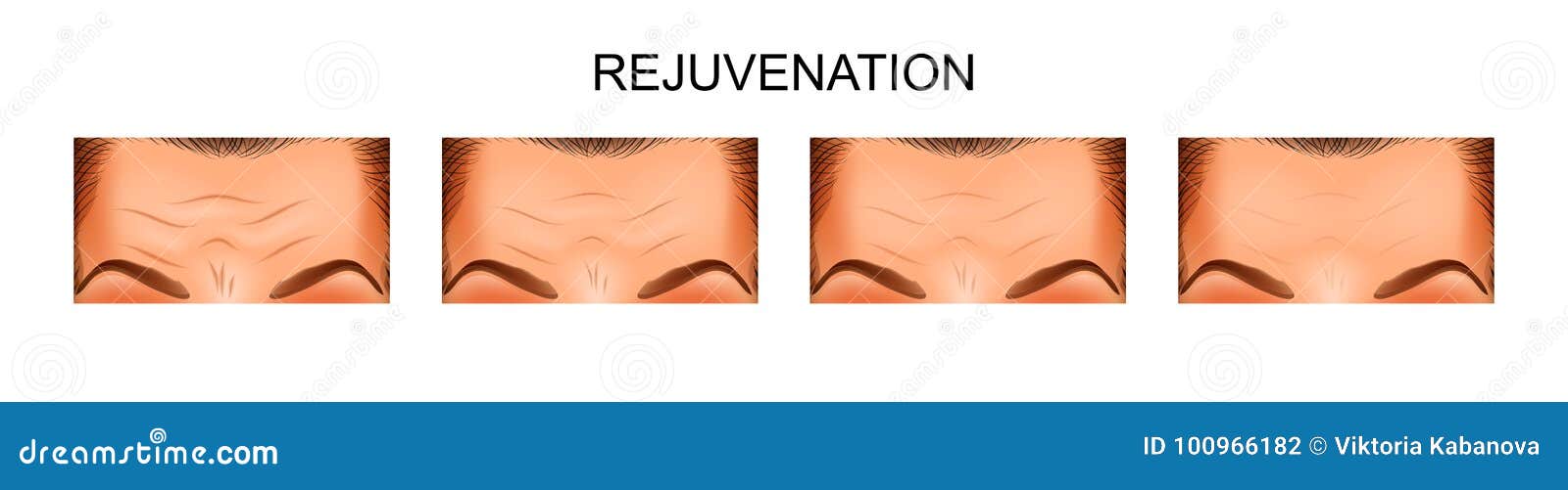 Skin rejuvenation forehead stock vector. Illustration of face - 100966182
