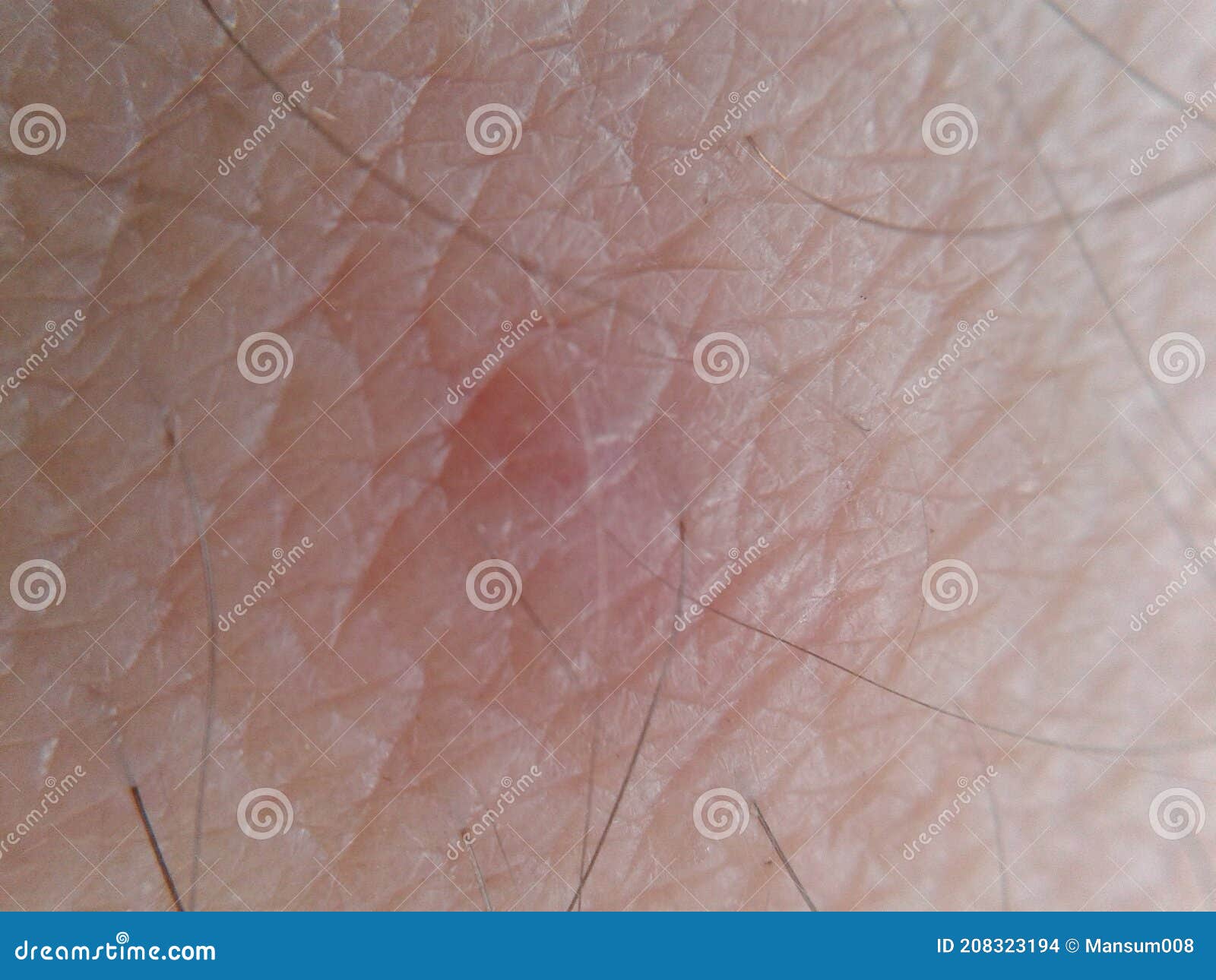 Skin and scars on foot stock photo. Image of texture - 208323194