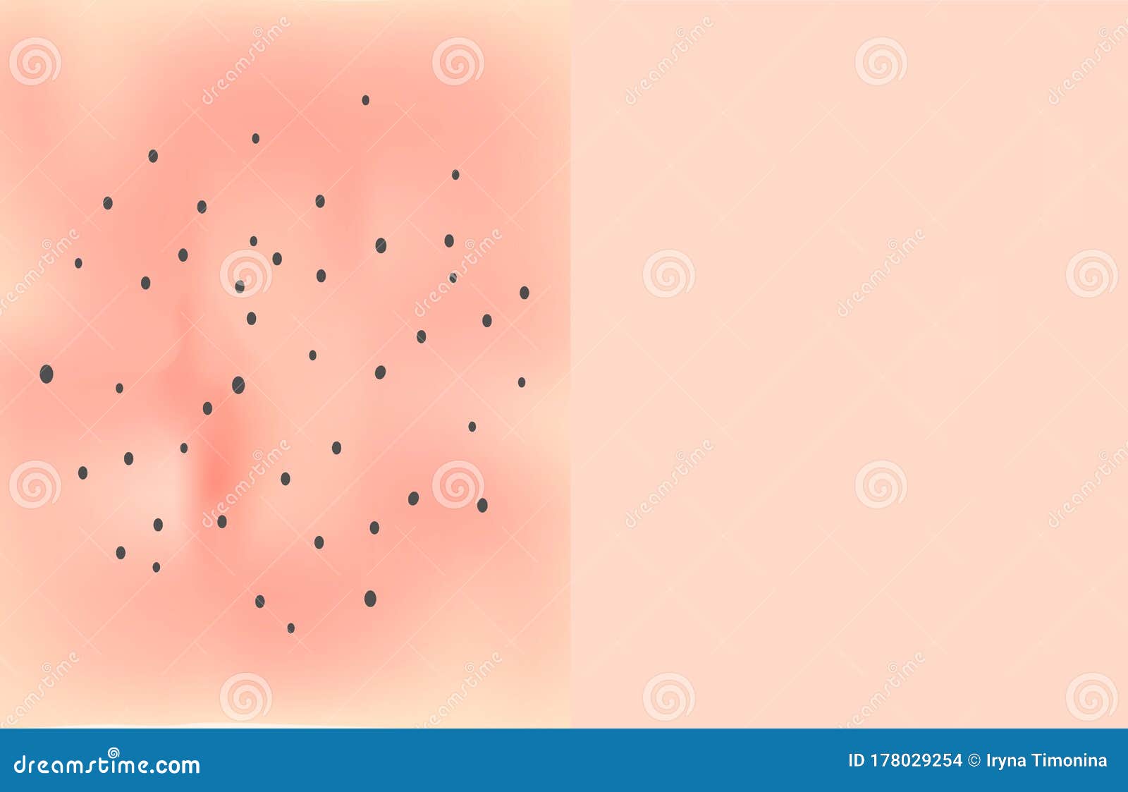 Texture With Acne Scars And Acne. Before After Scar Cysts. Skin ...