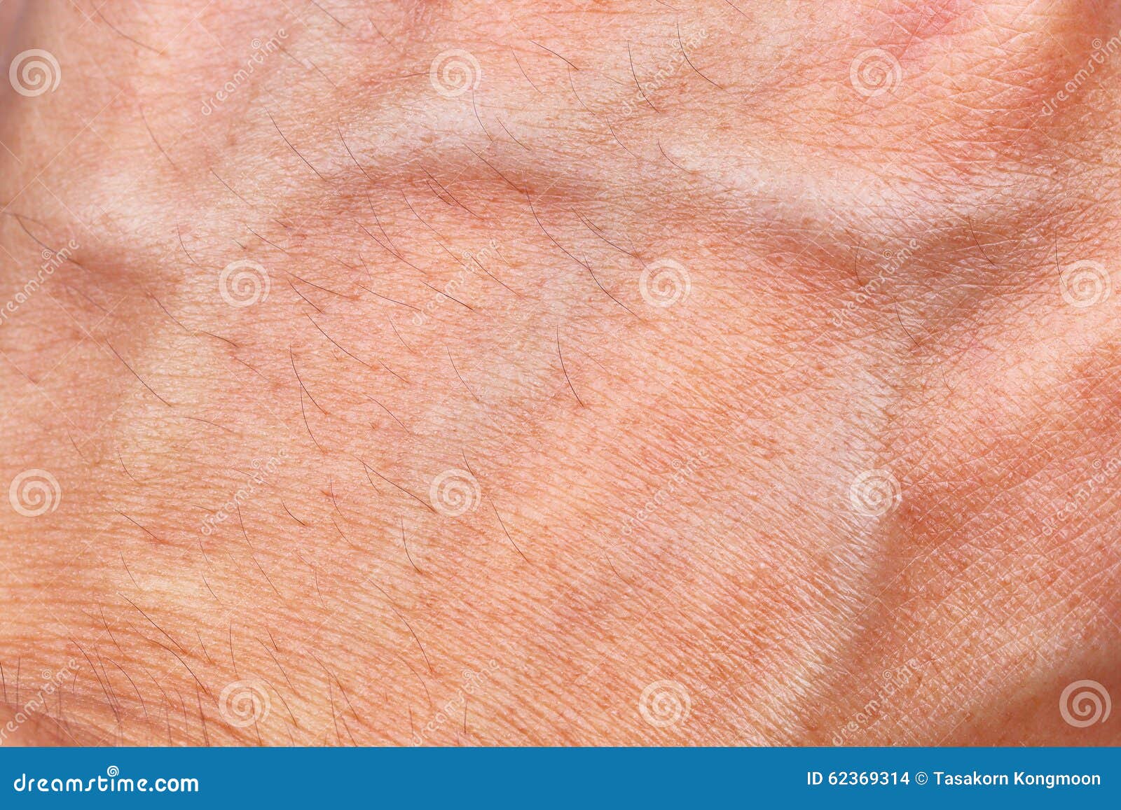 Skin Texture with Blood Vessel and Hair Stock Photo - Image of ...